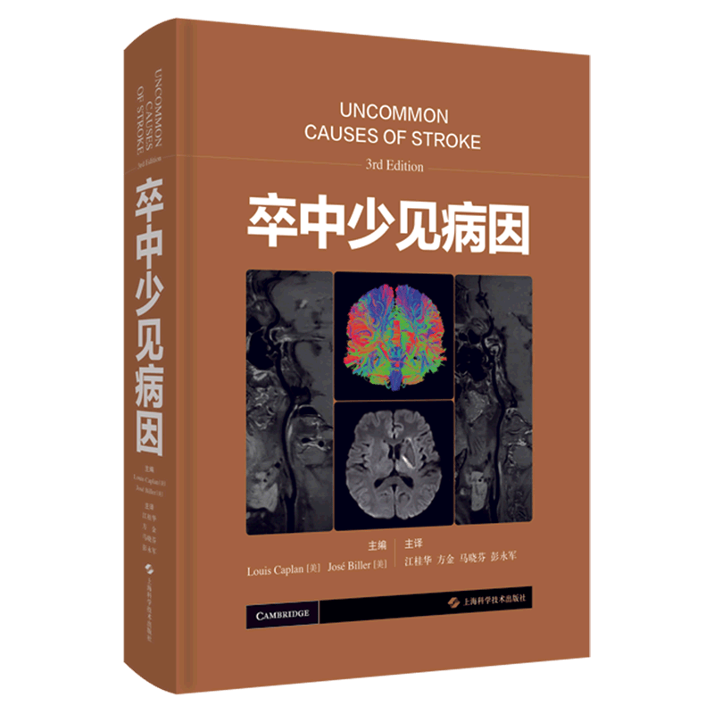 卒中少见病因(精)