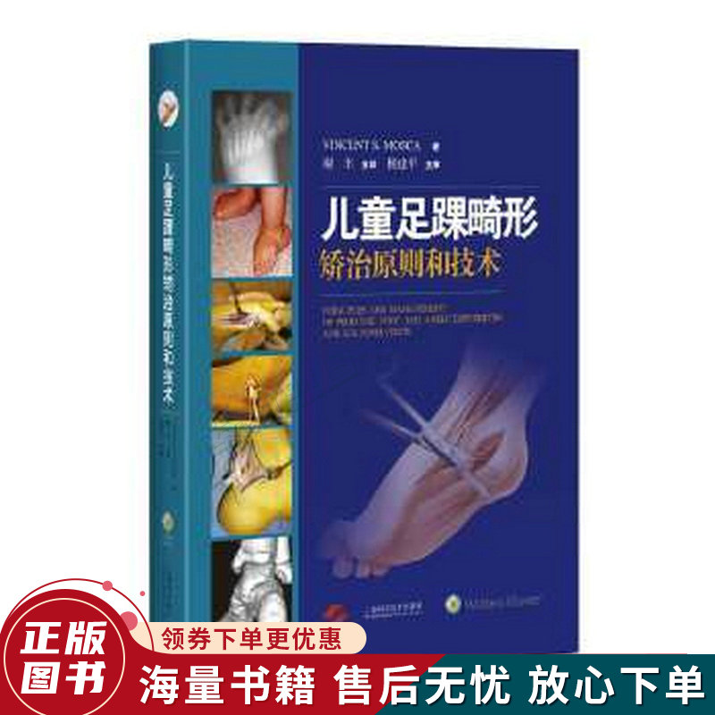 儿童足踝畸形矫治原则和技术