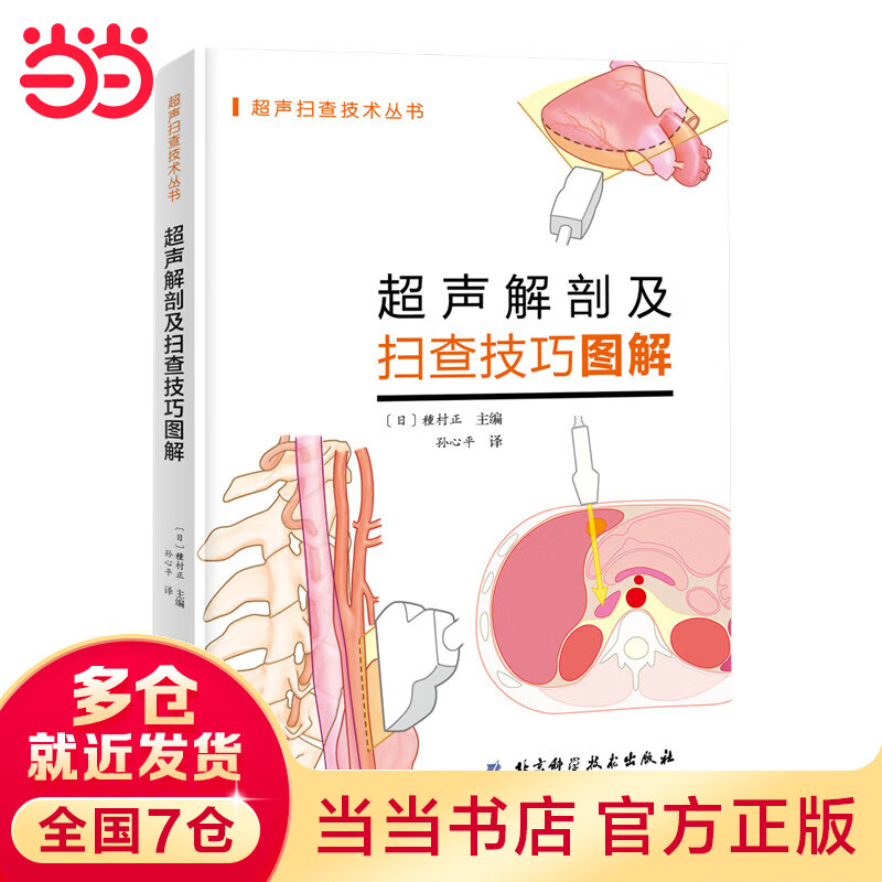 超声解剖及扫查技巧图解