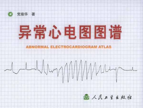 异常心电图图谱 党瑜华 著【书】