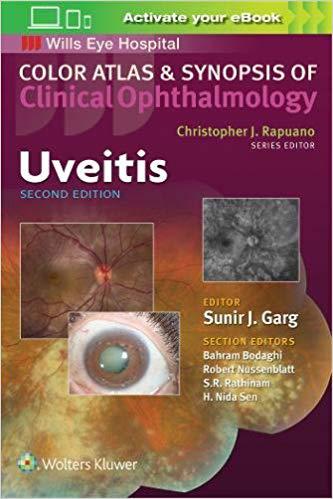 uveitis-千图网