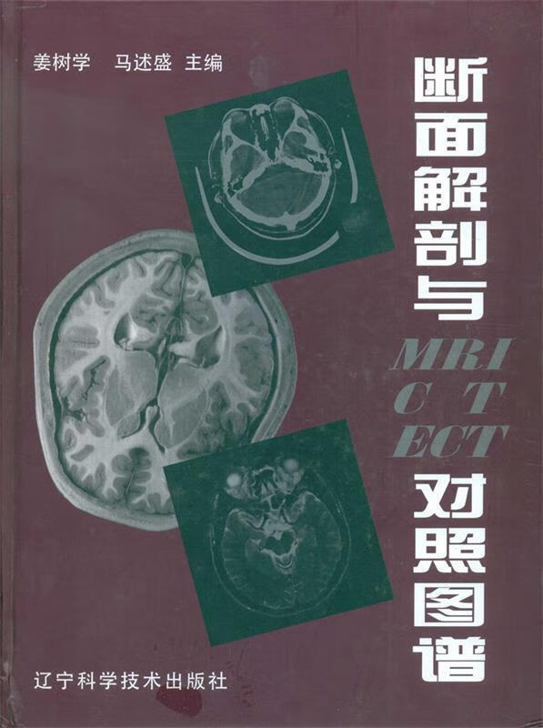 断面解剖与MRI CT ECT对照图谱 姜树学,马述盛 主编 辽宁科学技术出版社