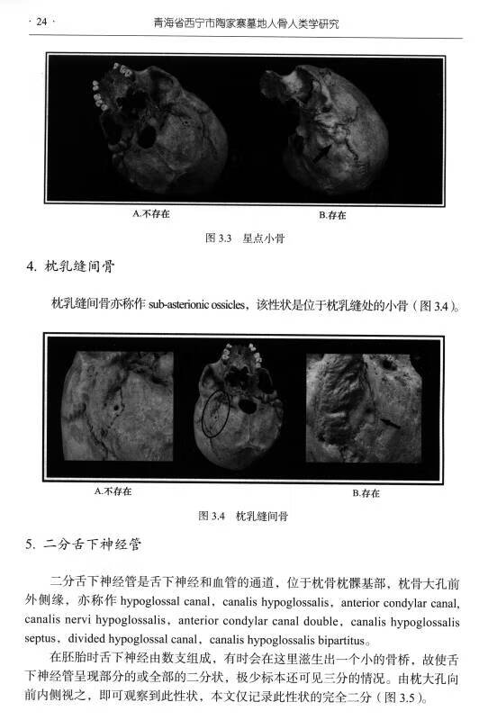 【书】青海省西宁市陶家寨墓地人骨人类学研究