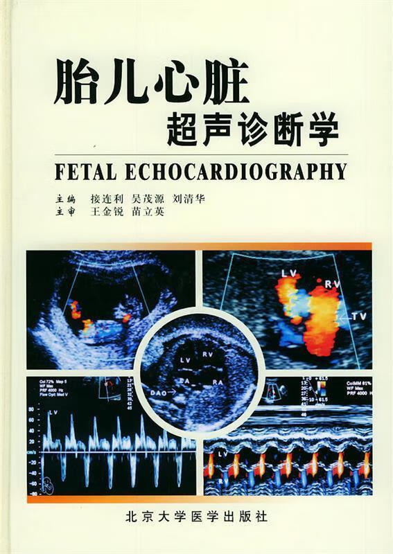 胎儿心脏超声诊断学