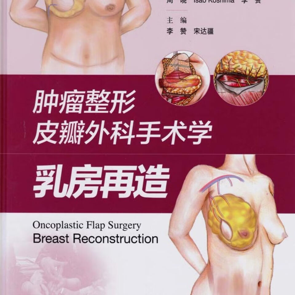 肿瘤整形皮瓣手术学乳房再造 李赞 周晓 腹壁下动脉穿支皮瓣