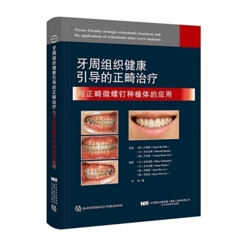 高清彩色 牙周组织健康引导的正畸治疗与正畸微螺钉种植体的应用