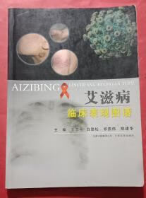 艾滋病临床表现图谱