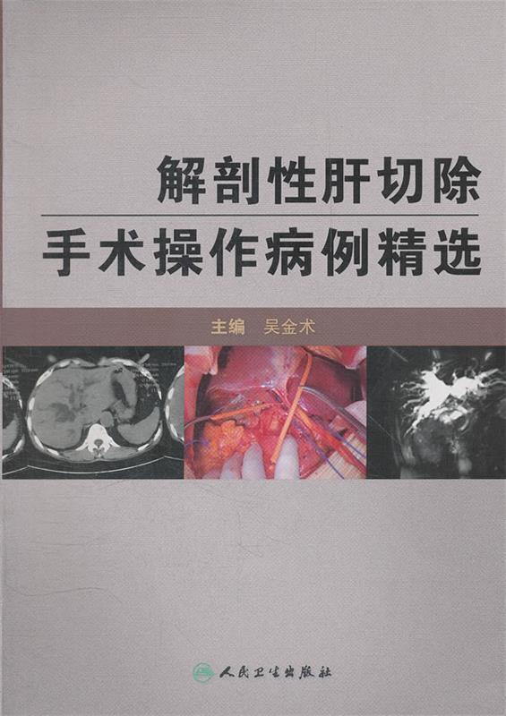解剖性肝切除手术操作病例精选
