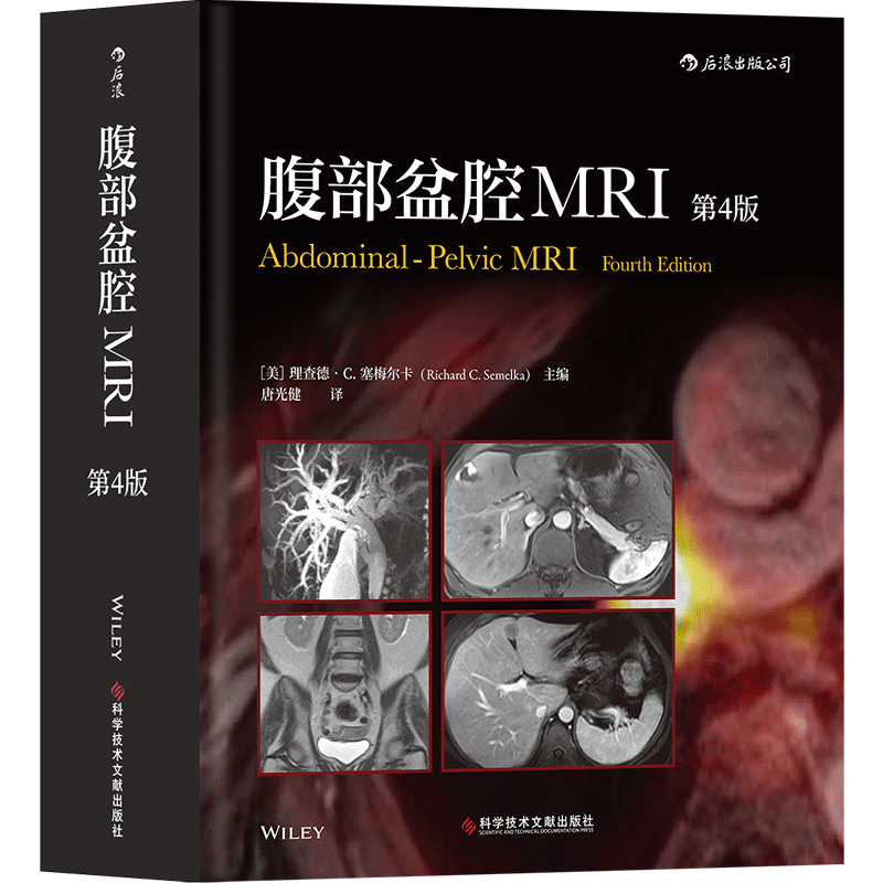 腹部盆腔MRI(第4版)(精)