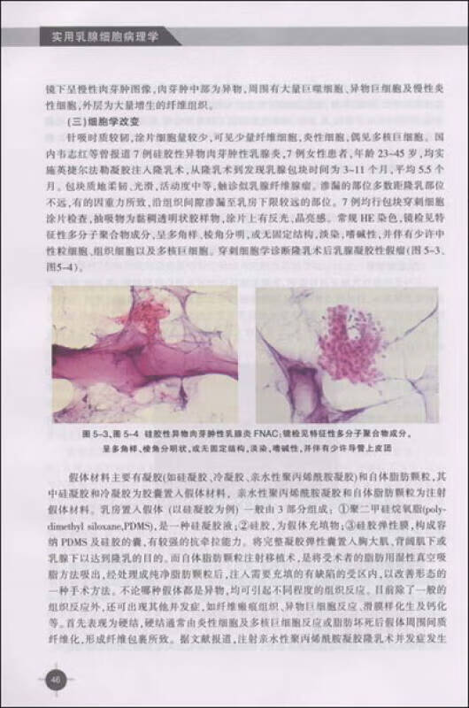 【书】实用乳腺细胞病理学