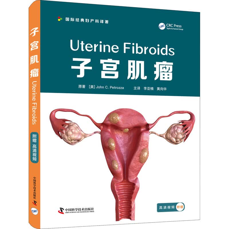 子宫肌瘤