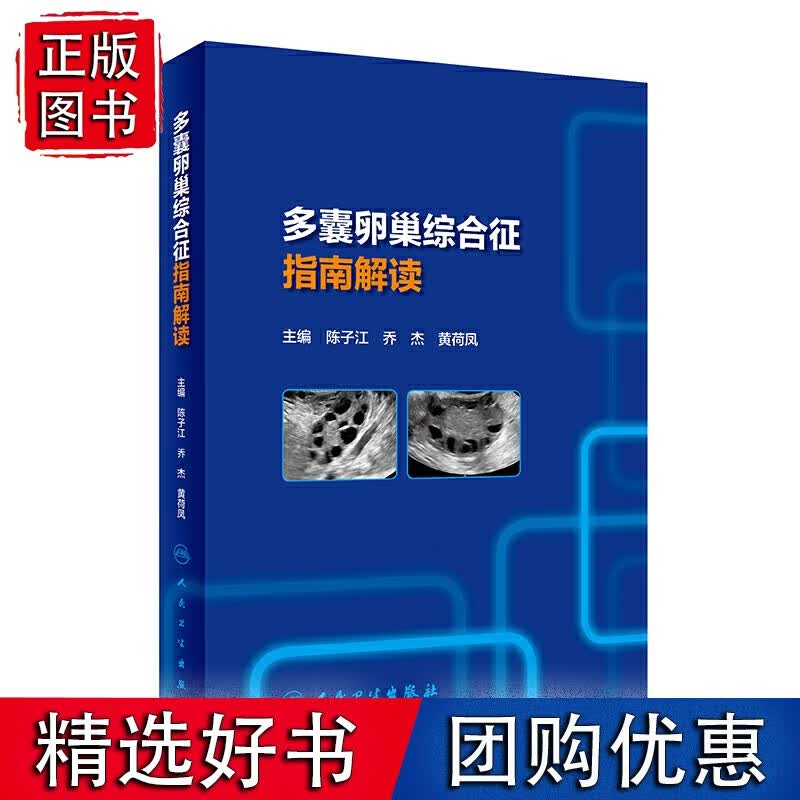 多囊卵巢综合征指南解读