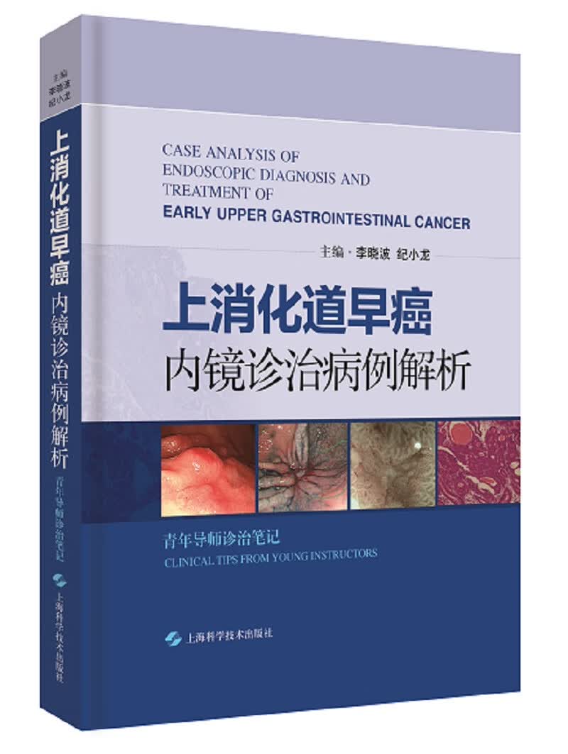 上消化道早癌内镜诊治病例解析