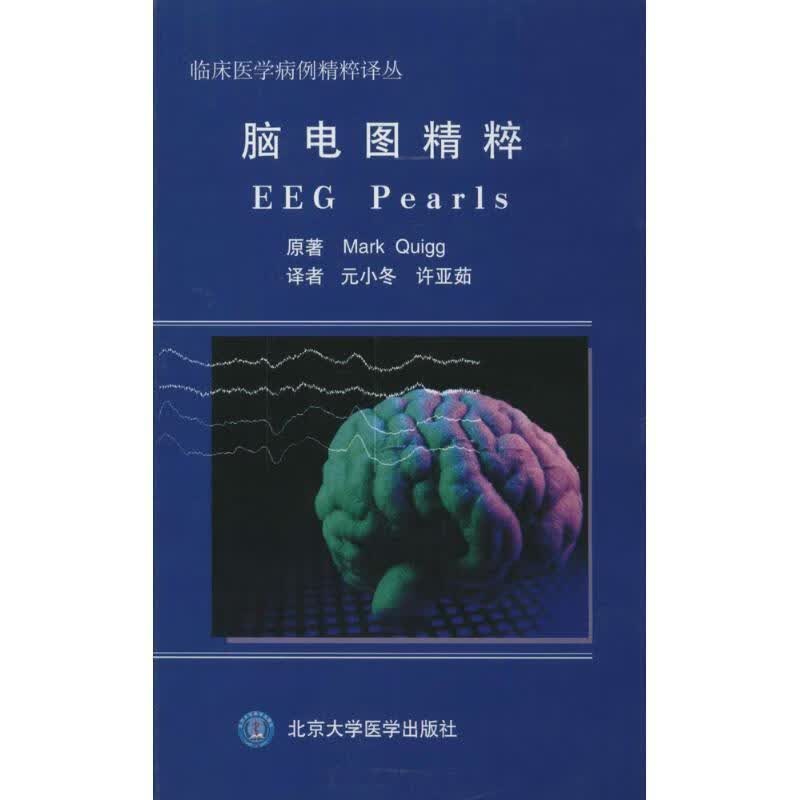 脑电图精粹