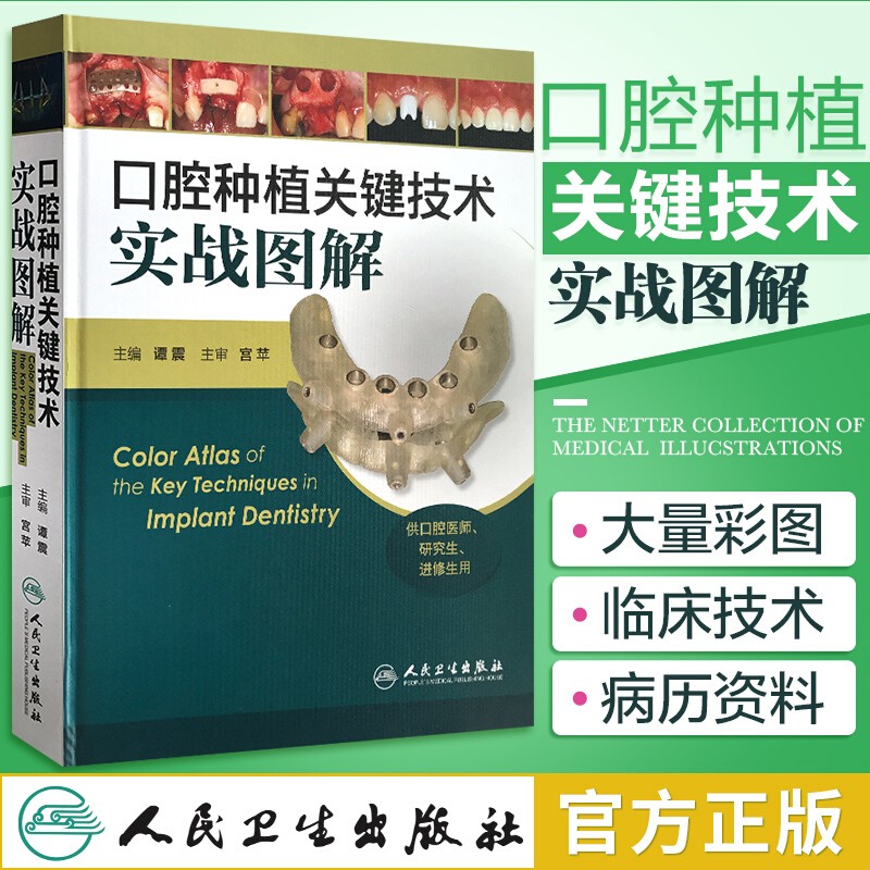 口腔种植关键技术实战图解人卫版供口腔医师研究生进修生用书口腔种植医学书籍医师临床用书彩印精装版