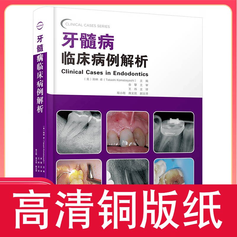 牙髓病临床病例解析 110克激光纸