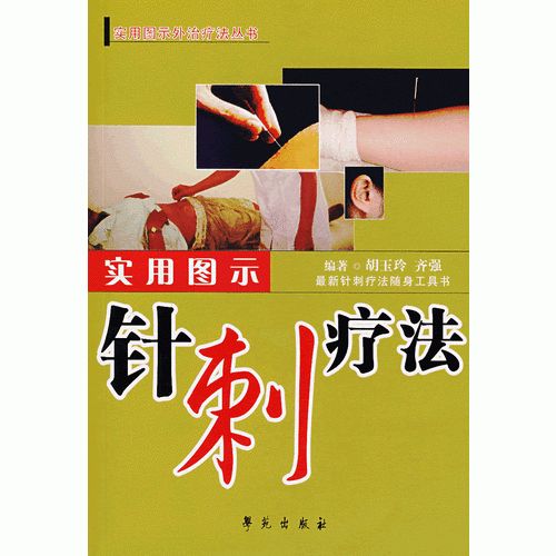 实用图示针刺疗法