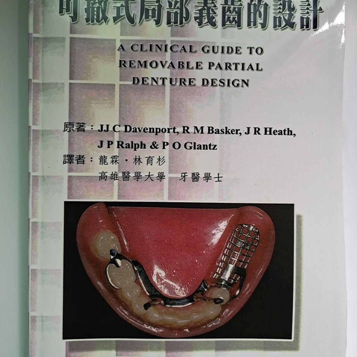 高清彩色 可撤式局部义齿的