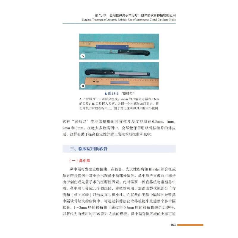 萎缩性鼻炎 从鼻腔病理到空鼻综合征 图书
