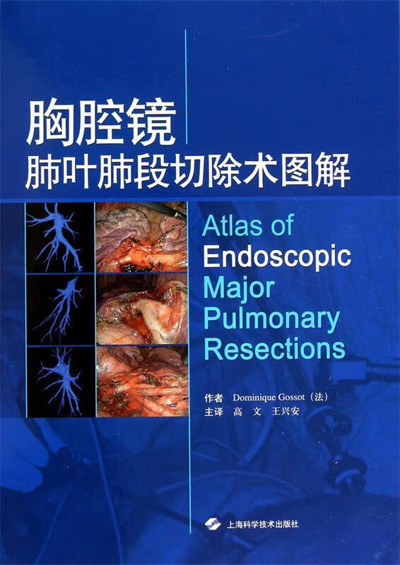 【现货】胸腔镜肺叶肺段切除术图解
