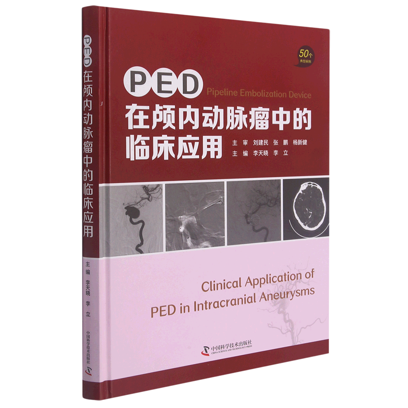 PED在颅内动脉瘤中的临床应用(精)