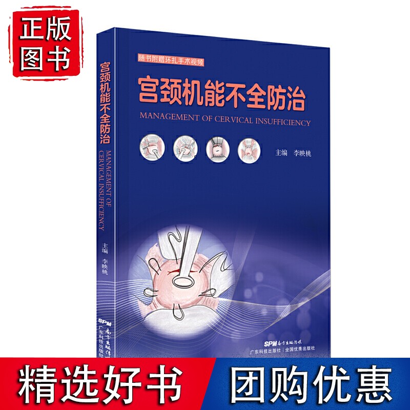 宫颈机能不全防治