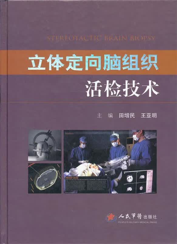 立体定向脑组织活检技术