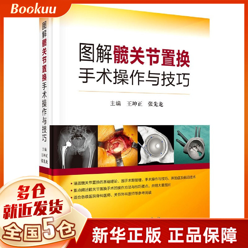 图解髋关节置换手术操作与技巧(精)