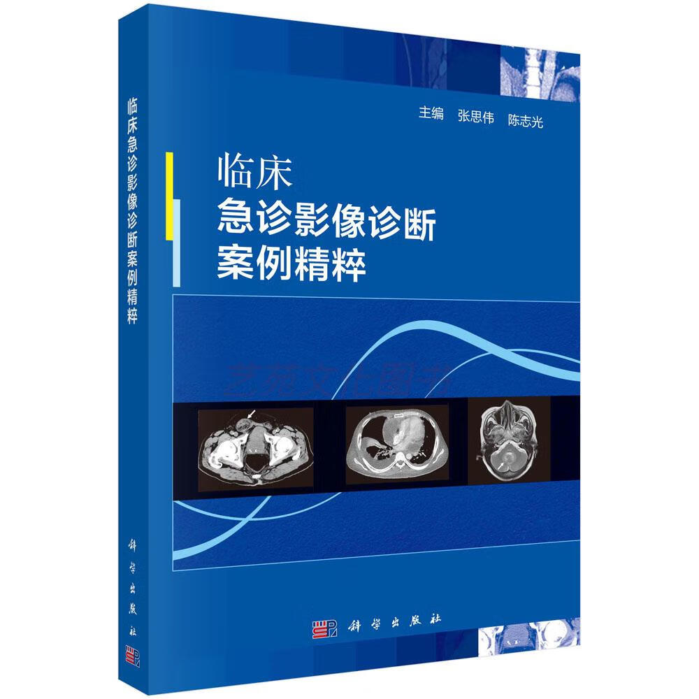 临床急诊影像诊断案例精粹 急诊学 断案例精粹
