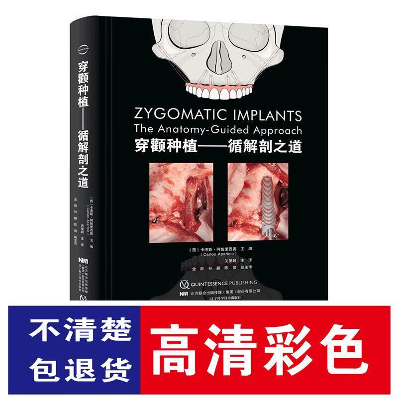 穿颧种植 循解剖之道