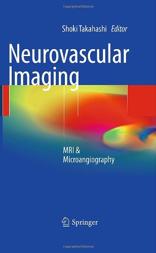 Neurovascular Imaging: MRI &