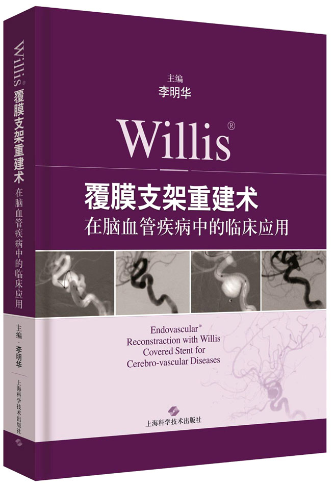 Willis覆膜支架重建术在脑血管疾病中的临床应用