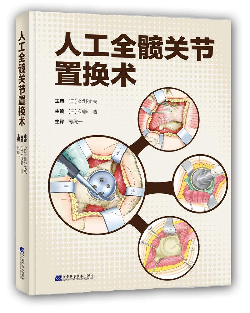 人工全髋关节置换术