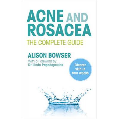 Acne and Rosacea: The Complete Guide