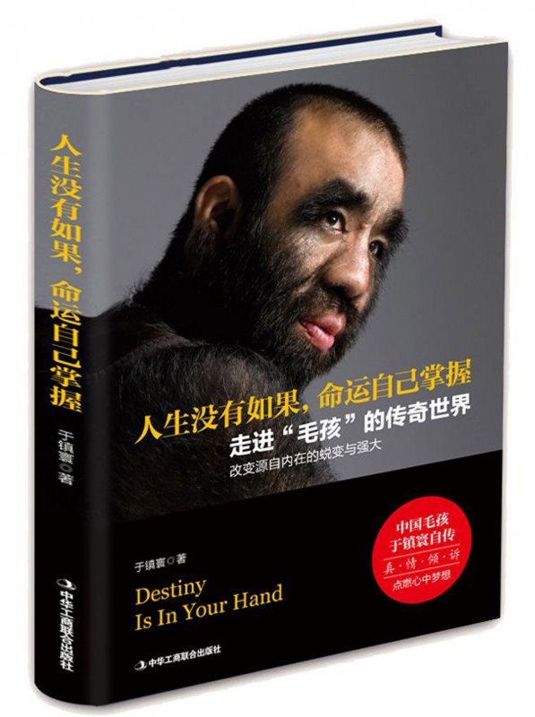人生没有如果命运自己掌握(走进毛孩的传奇世界)