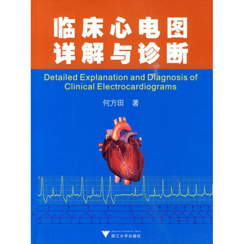 临床心电图详解与诊断