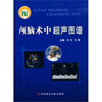 颅脑术中超声图谱