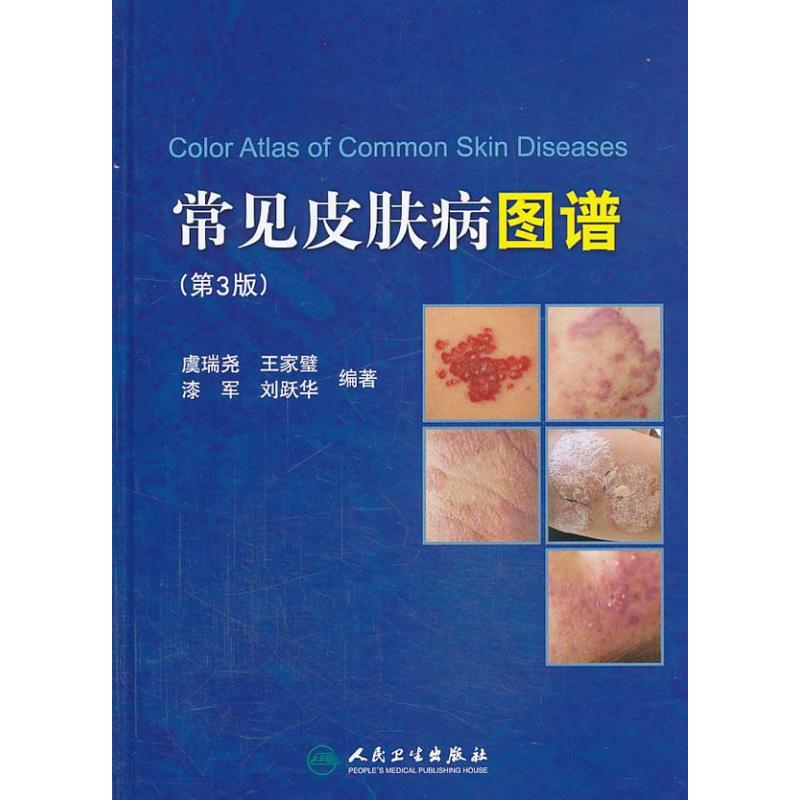 常见皮肤病图谱 (第3版)