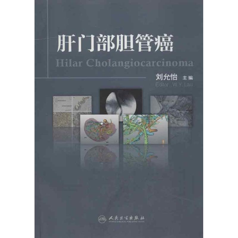 肝门部胆管癌