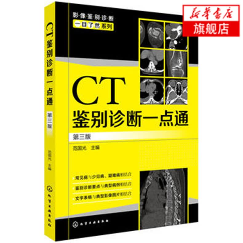 CT鉴别诊断一点通(第3版)