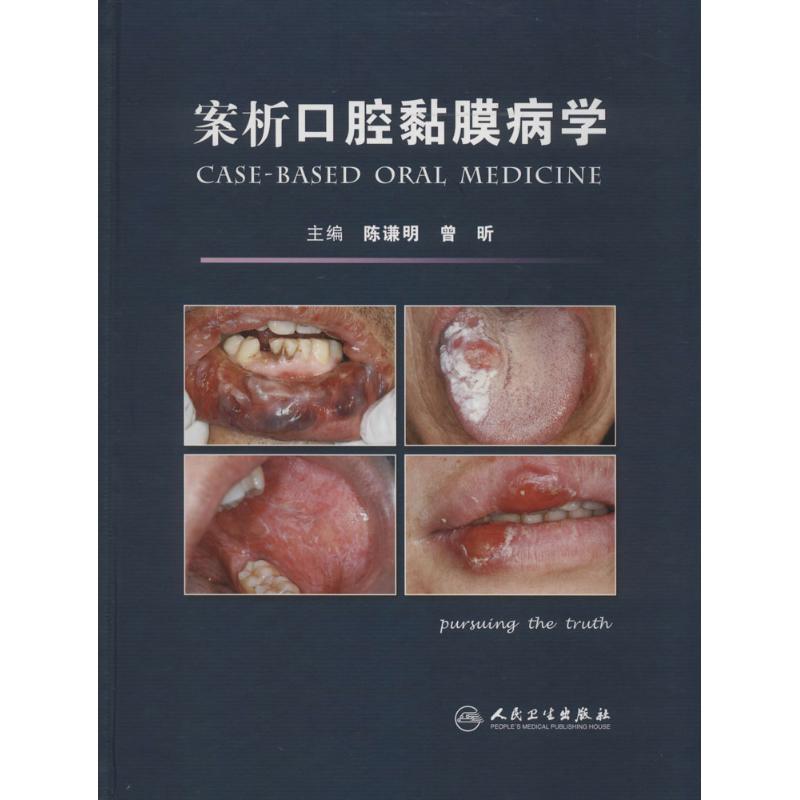 案析口腔黏膜病学