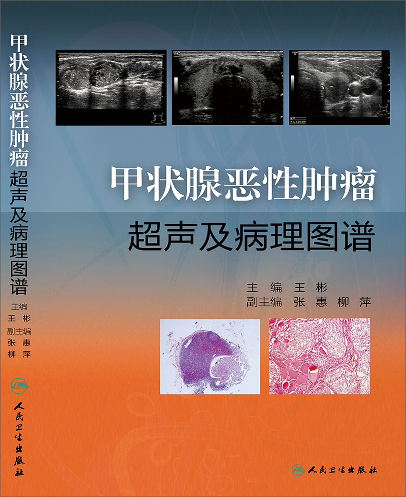 甲状腺恶性肿瘤超声及病理图谱 人民卫生 9787117186445