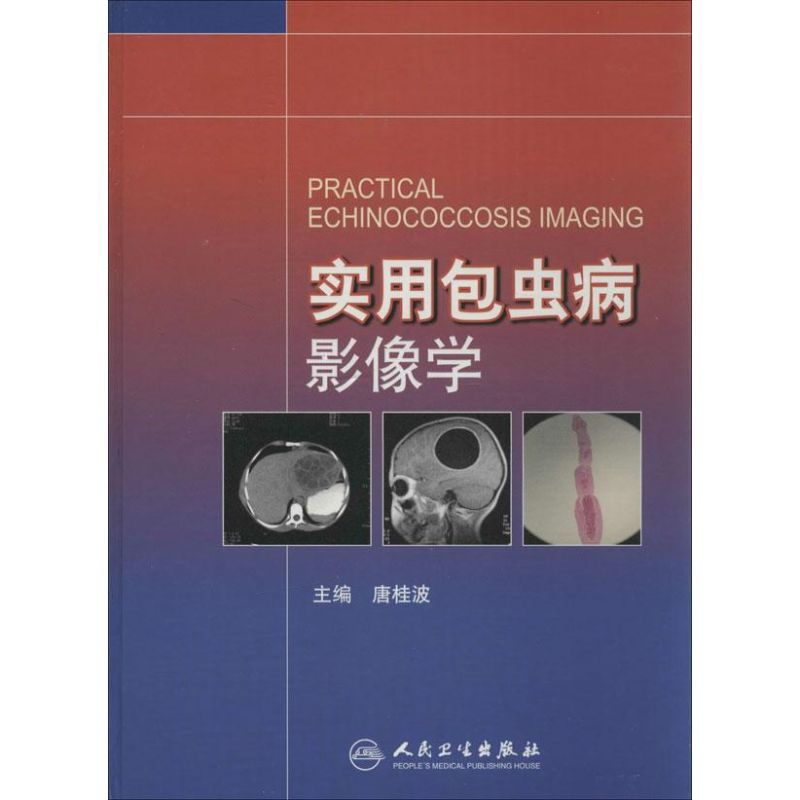 实用包虫病影像学