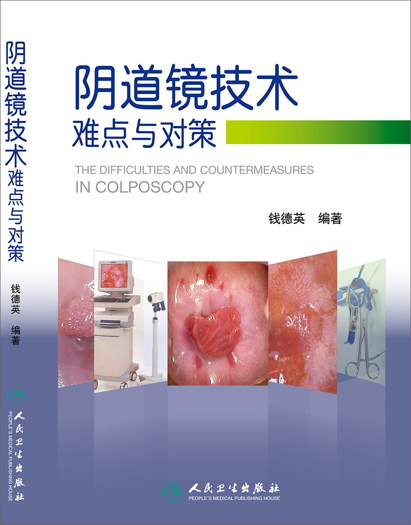 阴道镜技术难点与对策