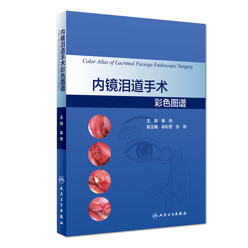 内镜泪道手术彩色图谱