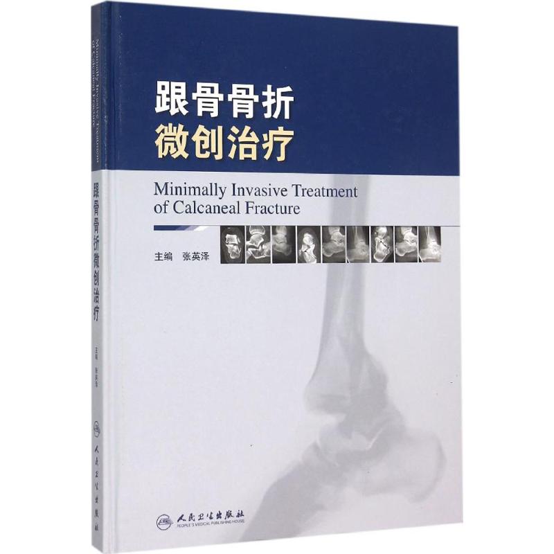 跟骨骨折微创治疗
