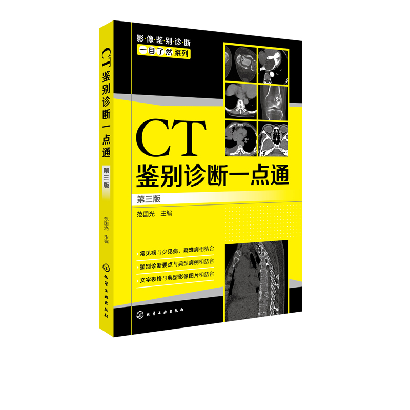 CT鉴别诊断一点通 第三版 医学影像学书籍 影像学诊断图谱 病症诊断与鉴别诊断参考书 影像医