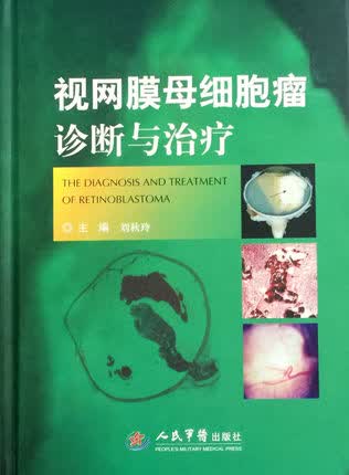 视网膜母细胞瘤诊断与治疗9787509186220 86220