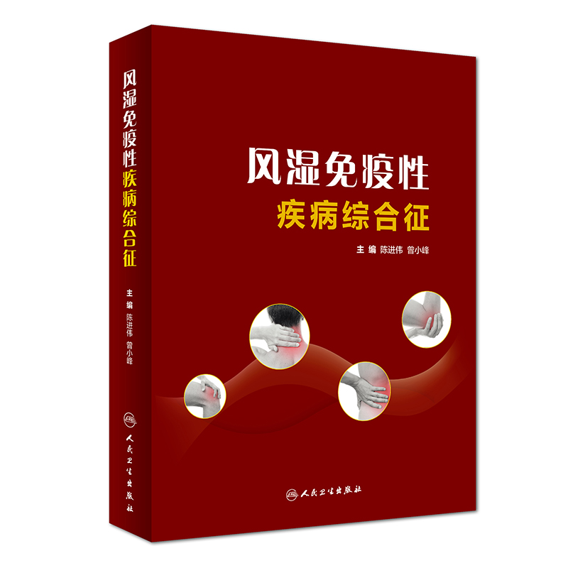 风湿免疫性疾病综合征