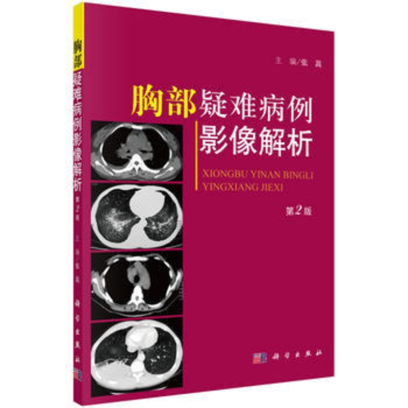 胸部疑难病例影像解析第2版 影像分析 医学放射学 影像诊断学 呼吸系及胸部疾病 诊断思维过